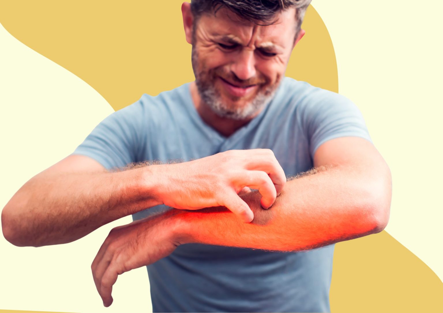4 Ways To Treat Jock Itch Complete Guide 2024 4 Ways To Treat Jock