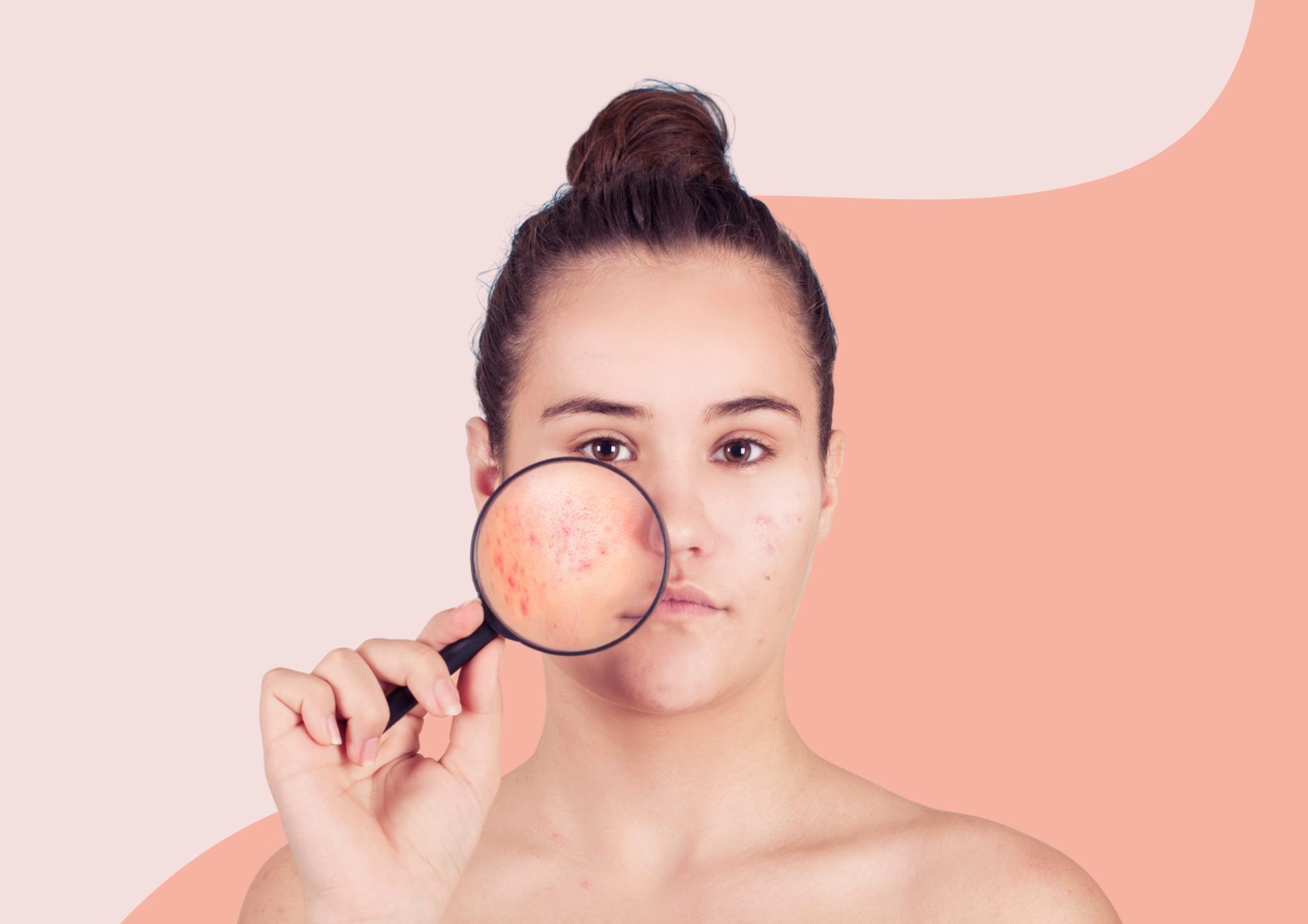 3 Ways To Remove Dark Spots On Your Face According To Dermatologists 3 ...